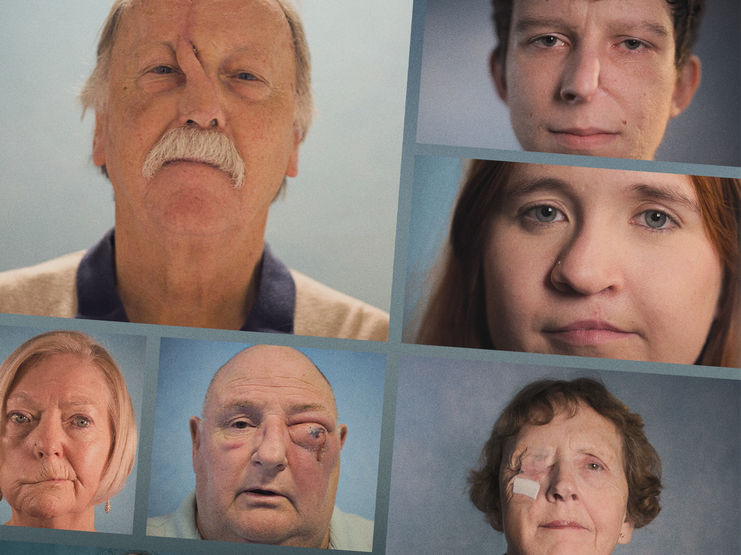 The Face Doctors on TV | Series 1 Episode 1 | Channels and schedules ...